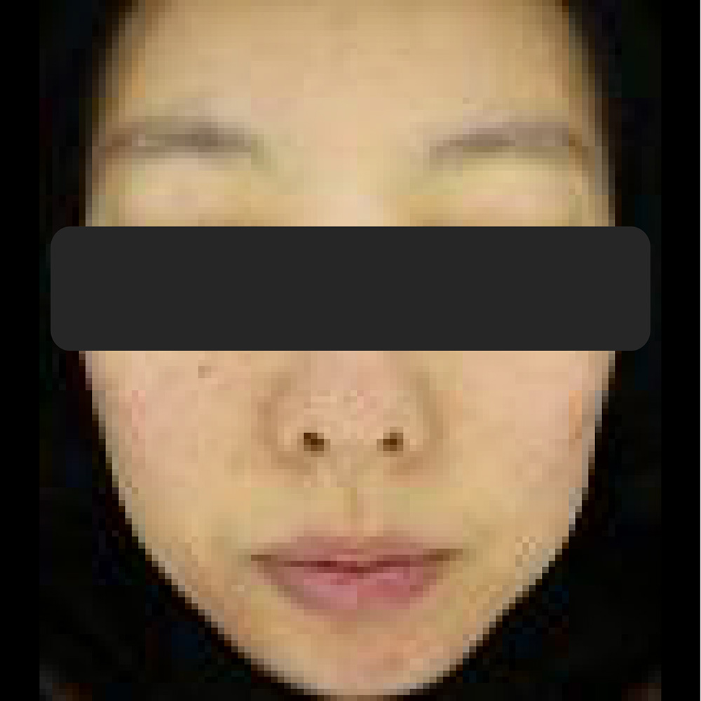 P198 ExoHealer - Exosome บริสุทธิ์จาก Stem Cell ส่วนที่ดีที่สุด